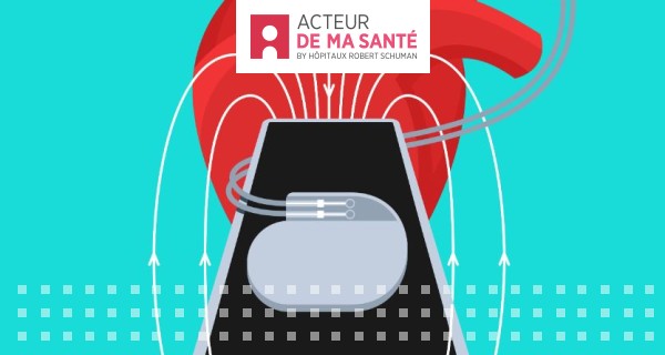 Implantierbarer Kardioverter-Defibrillator: Funktionsweise