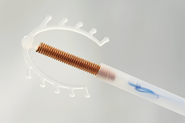 La contraception d'urgence : et si le DIU était une solution
